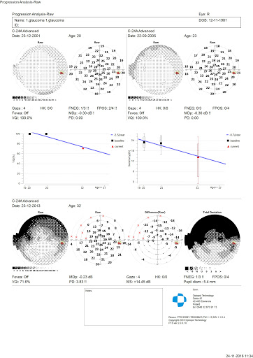 Campimetro computarizado Optopol PTS920 – Isolab